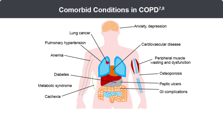 Pathophysiology – COPD Clinician